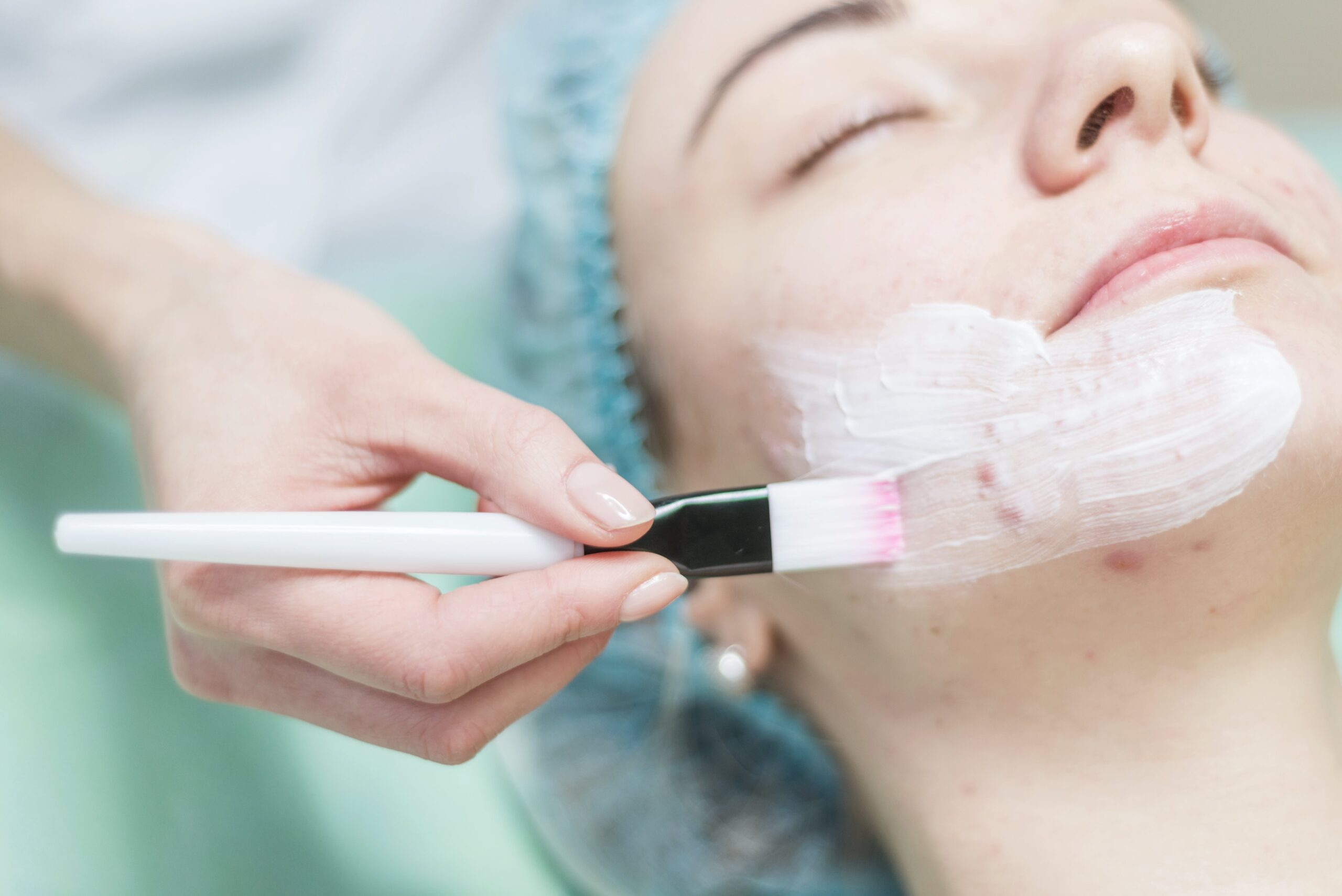 Acne Treatment Redcar | Skin Clinic: Innovations Advanced Skincare & Beauty